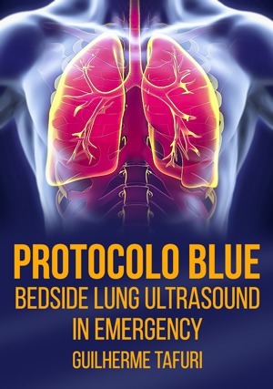 Assista online: Protocolo BLUE | Medstream